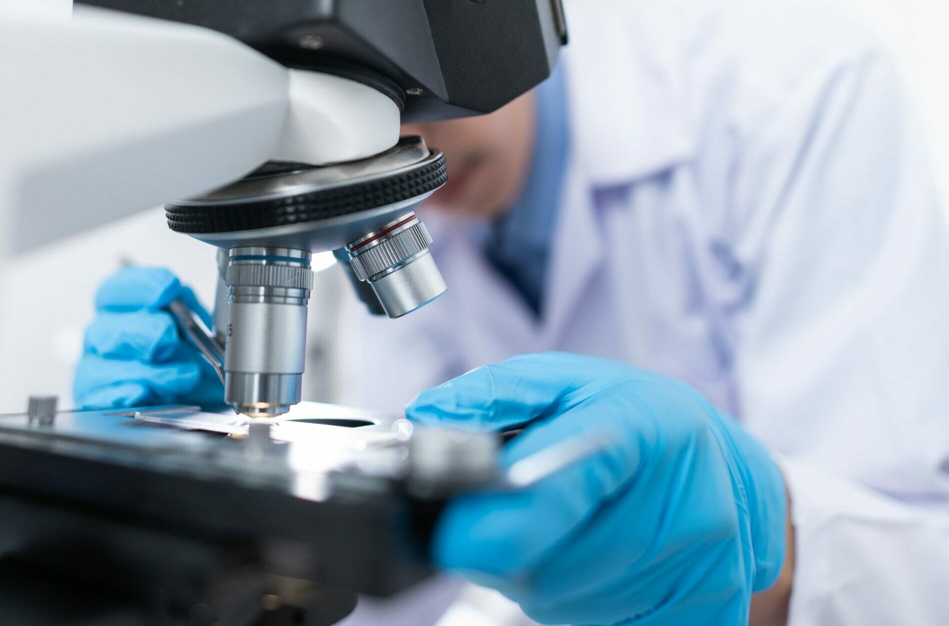 Was bedeuten die Stufen beim Pap-Abstrich? - GANZFRAU